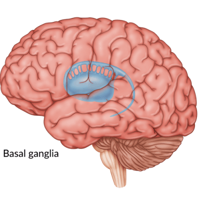 ACA Stroke: Damage to the Anterior Cerebral Artery