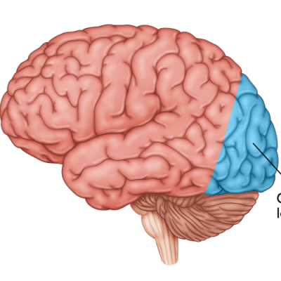 Frontal Lobe Stroke: Causes, Secondary Effects, & Recovery