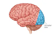 Can A Stroke Cause Blindness Home Interior Design Can A Stroke Cause Blindness Home Interior Design
