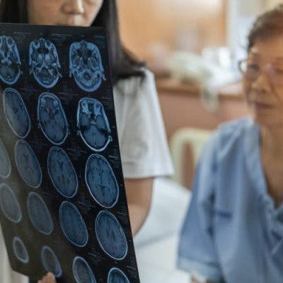 Focal Brain Injury: Your Guide to Treatment and Recovery